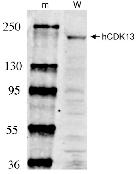 Anti-CDK13 | ABE1860